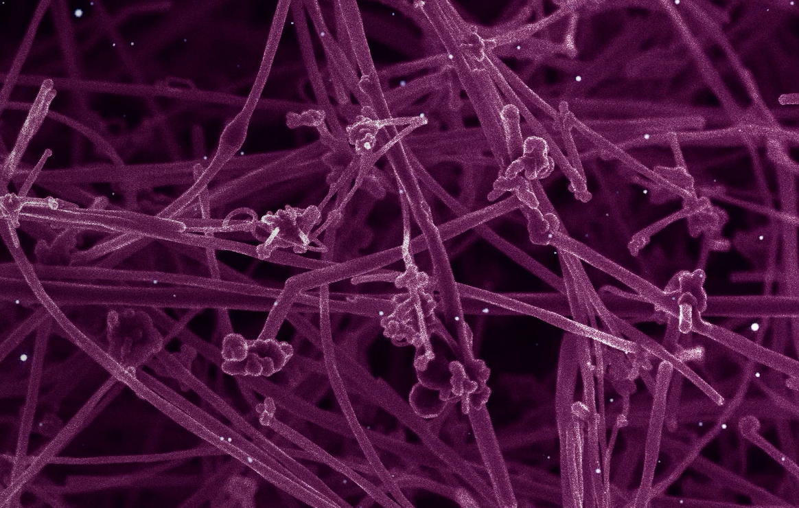 Occupational dust exposure | Innovationsgesellschaft mbH